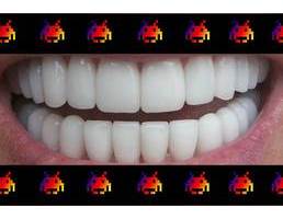 The Dental Arcade Game - SciStarter